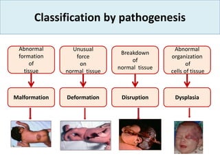 seminar birth defect | PPT