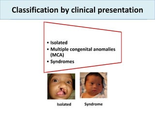 seminar birth defect | PPT