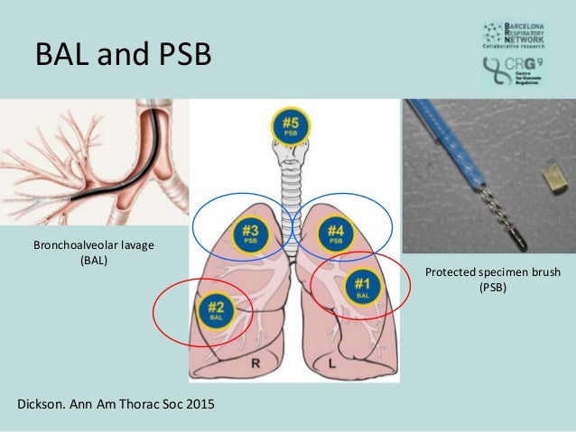 BRN Symposium 03/06/16 The respiratory microbiome: a new frontier in