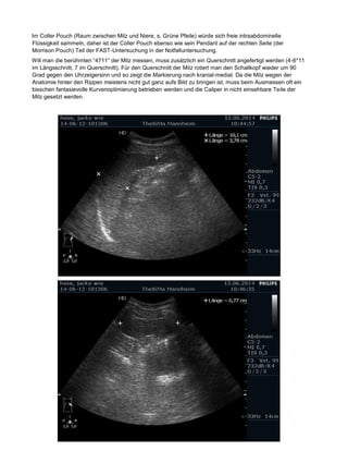 00 Sono Abdomen Grundkurs. Einführung zur Sonographie des Abdomens. | PDF