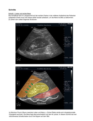 00 Sono Abdomen Grundkurs. Einführung zur Sonographie des Abdomens. | PDF