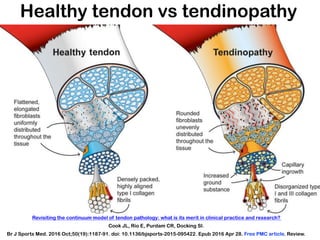 The Battle 2021 Castrocaro Terme (Italy). Achilles Insertional ...