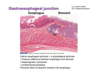 Gastroesophageal Junction Slide Labeled