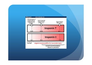 Cardiac Biomarkers in ACS | PDF