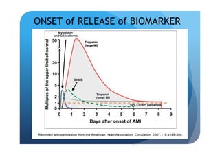 Cardiac Biomarkers in ACS | PDF