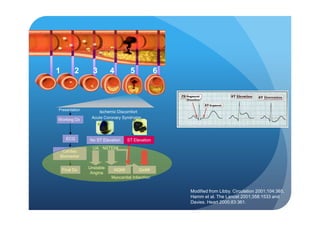 Cardiac Biomarkers in ACS | PDF