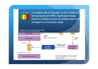 Cardiac Biomarkers in ACS | PDF