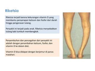 Sistem gerak pada manusia | PPT