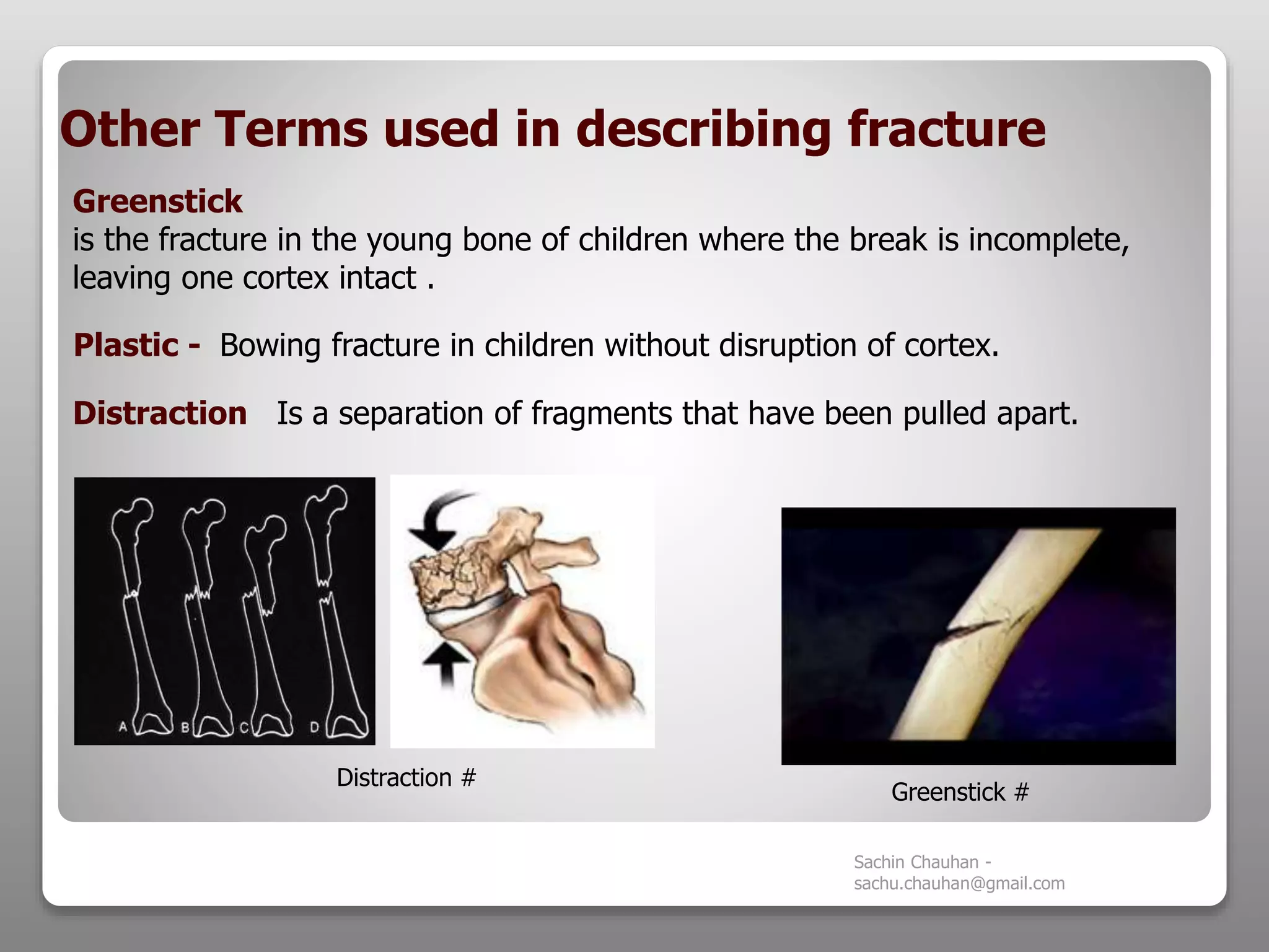 Fracture - Types, Complications & Management | PPTX