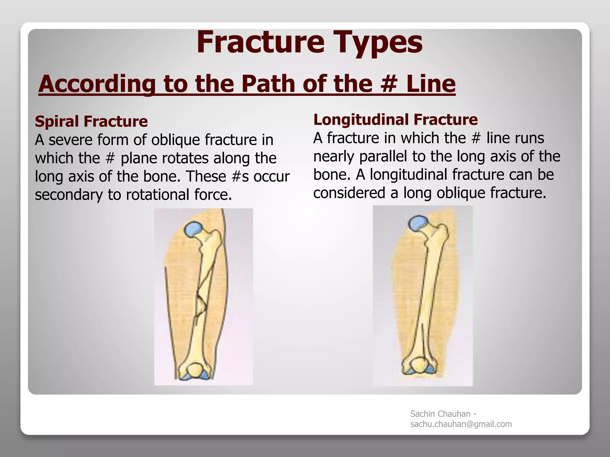 Fracture - Types, complications and management | PPTX