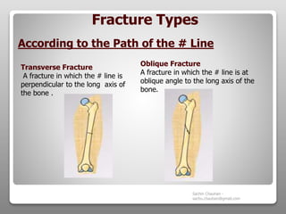 Fracture - Types, complications and management | PPTX