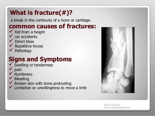 Fracture - Types, complications and management