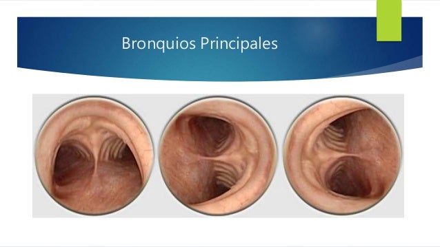Fibrobroncoscopia estructura y función de las vías aéreas inferiores