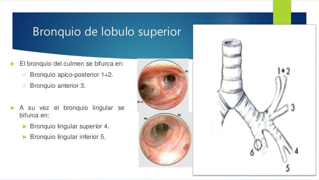 Fibrobroncoscopia estructura y función de las vías aéreas inferiores