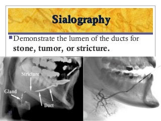 01. salivary glands examinations | PPT