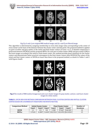 FUZZY SEGMENTATION OF MRI CEREBRAL TISSUE USING LEVEL SET ALGORITHM | PDF