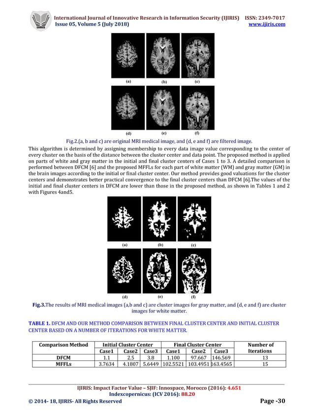 FUZZY SEGMENTATION OF MRI CEREBRAL TISSUE USING LEVEL SET ALGORITHM | PDF