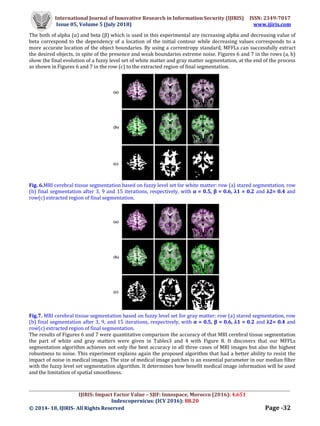 FUZZY SEGMENTATION OF MRI CEREBRAL TISSUE USING LEVEL SET ALGORITHM | PDF