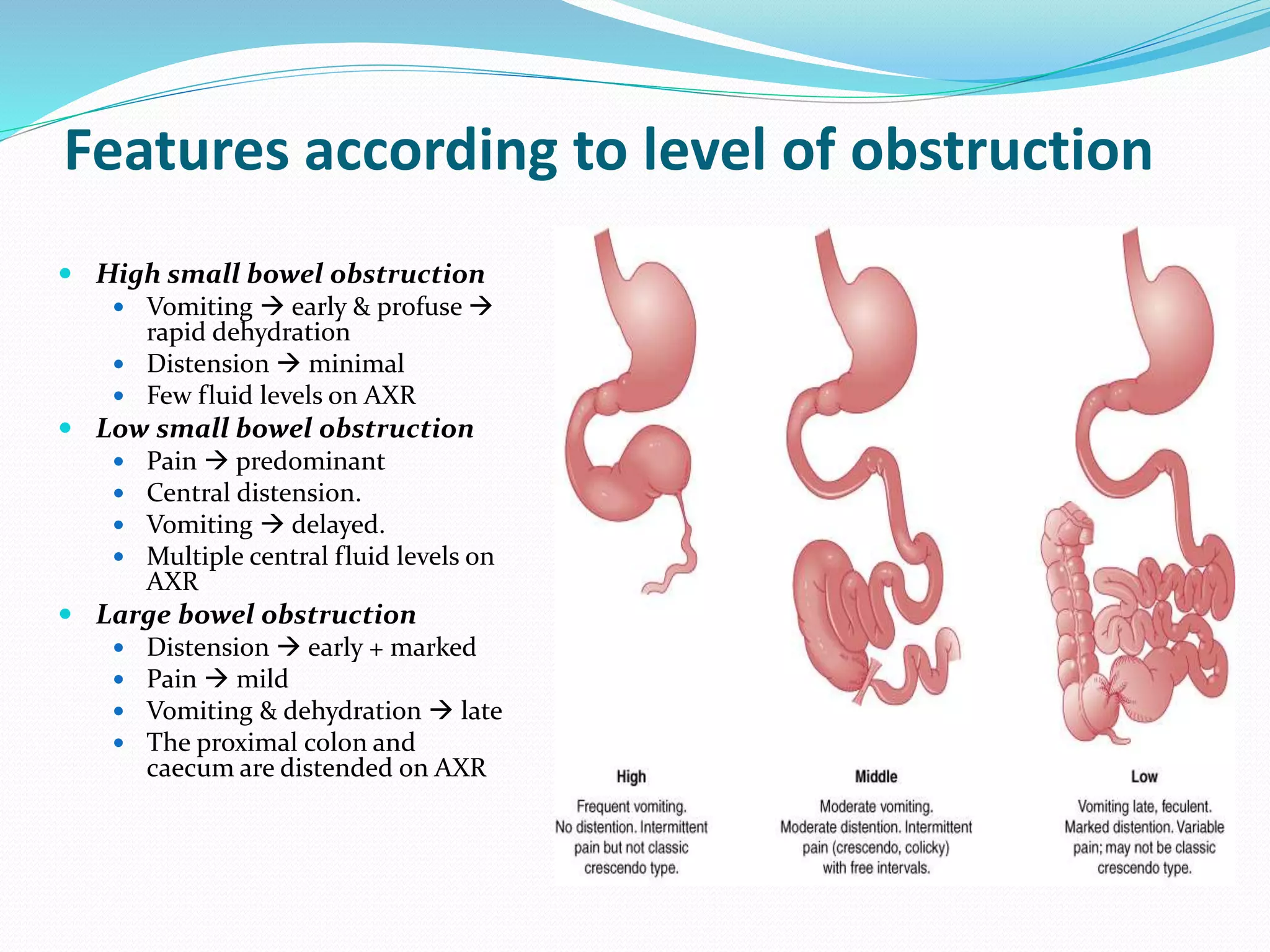 01.abdominal swelling 1 | PPTX