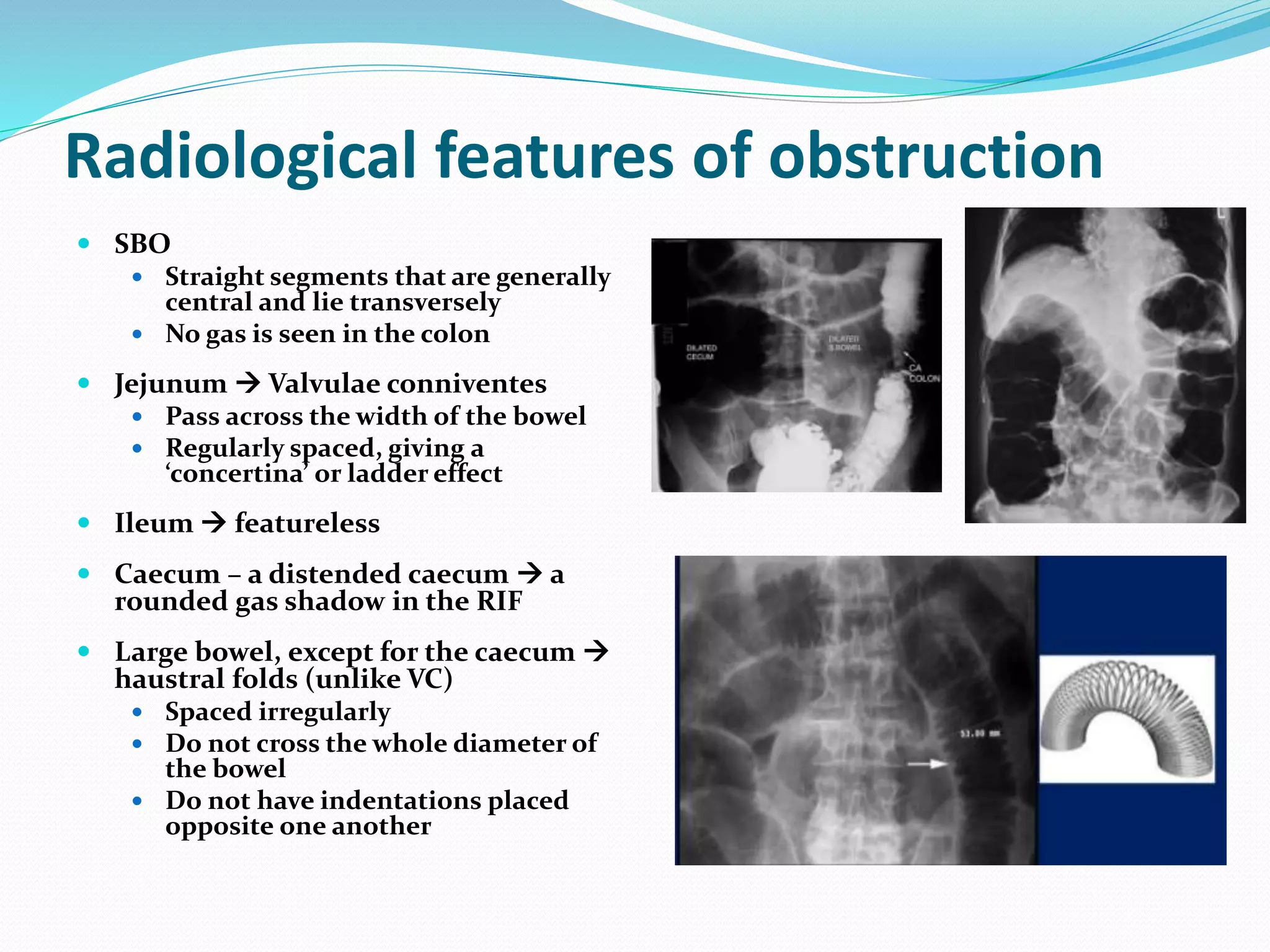 01.abdominal swelling 1 | PPTX