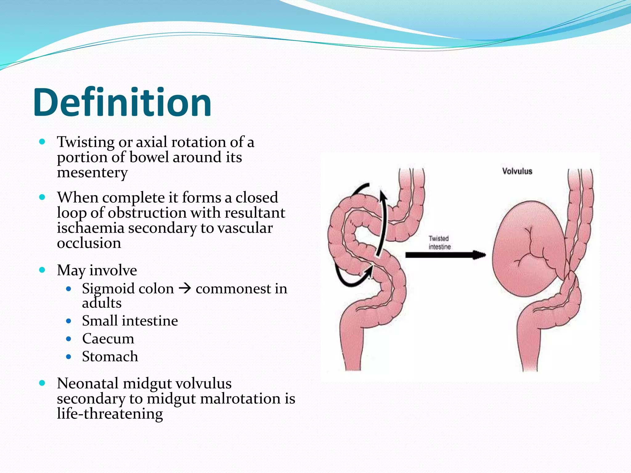 01.abdominal swelling 1 | PPTX