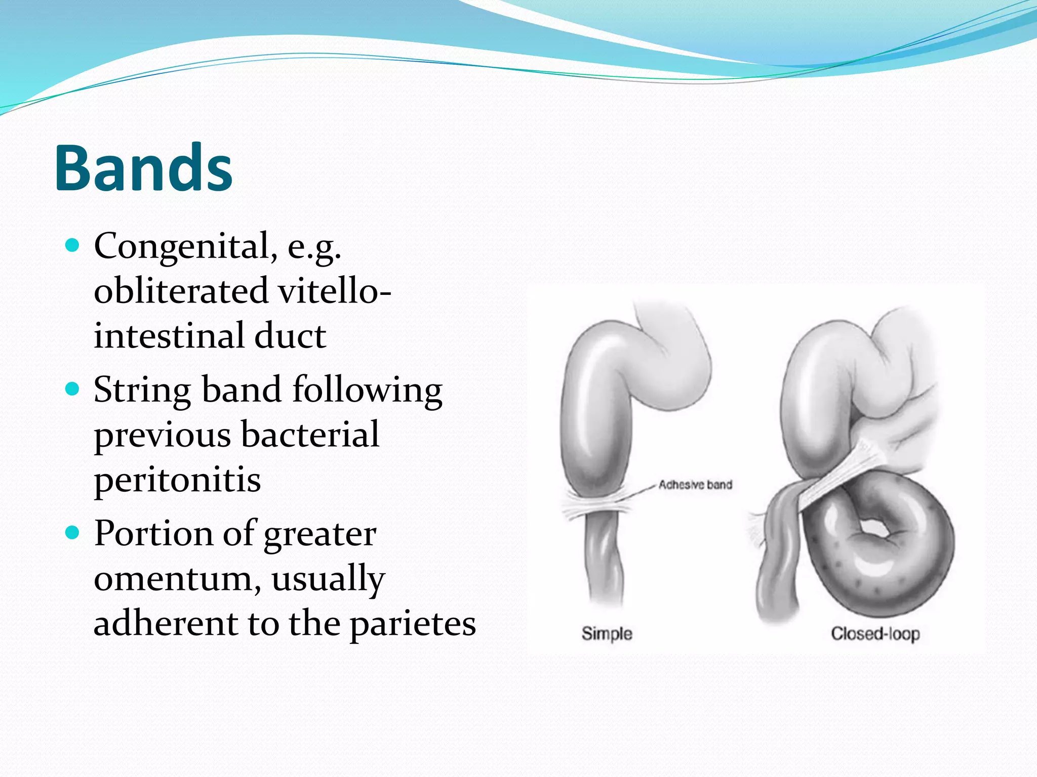 01.abdominal swelling 1 | PPTX