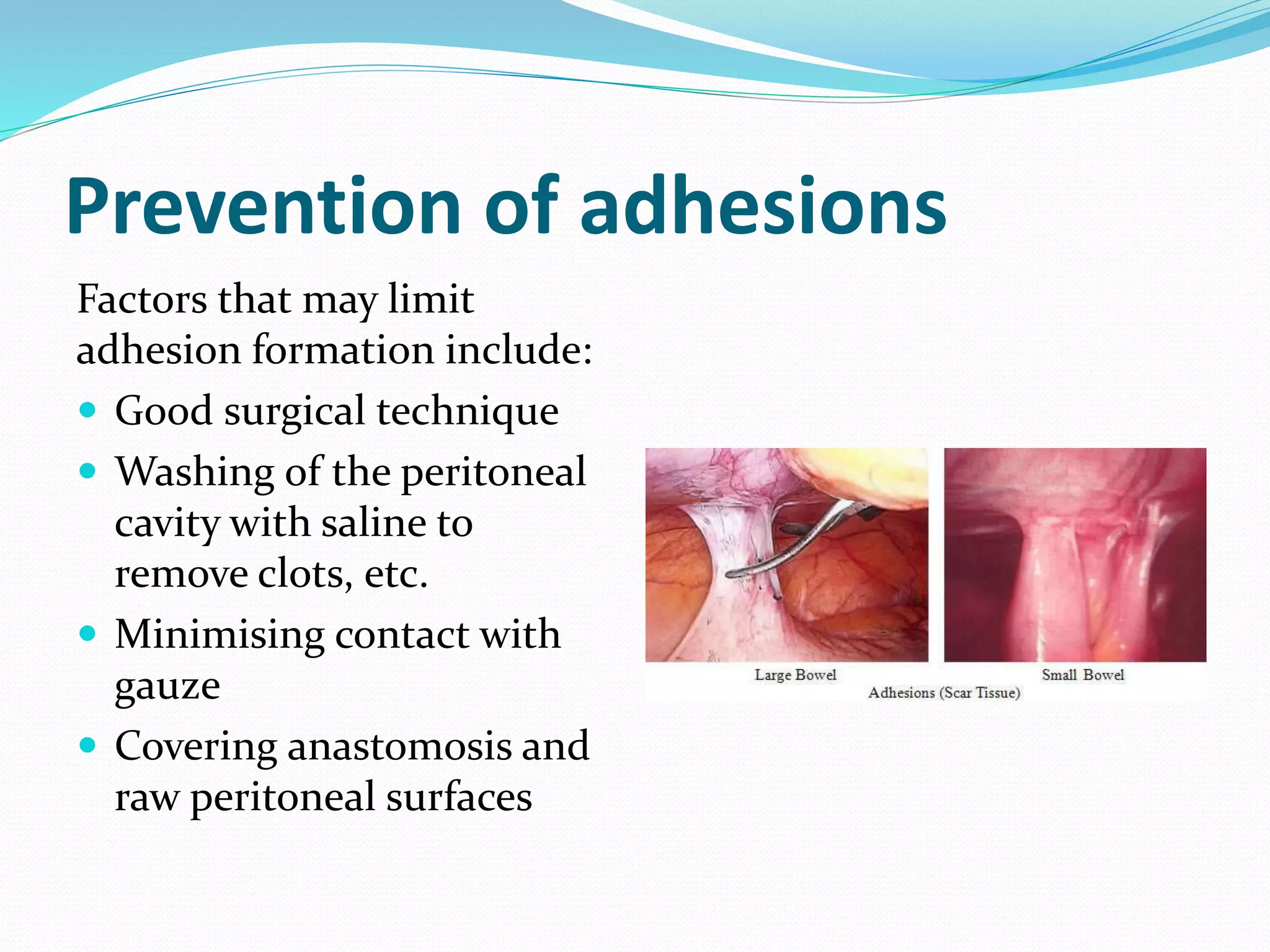01.abdominal swelling 1 | PPTX