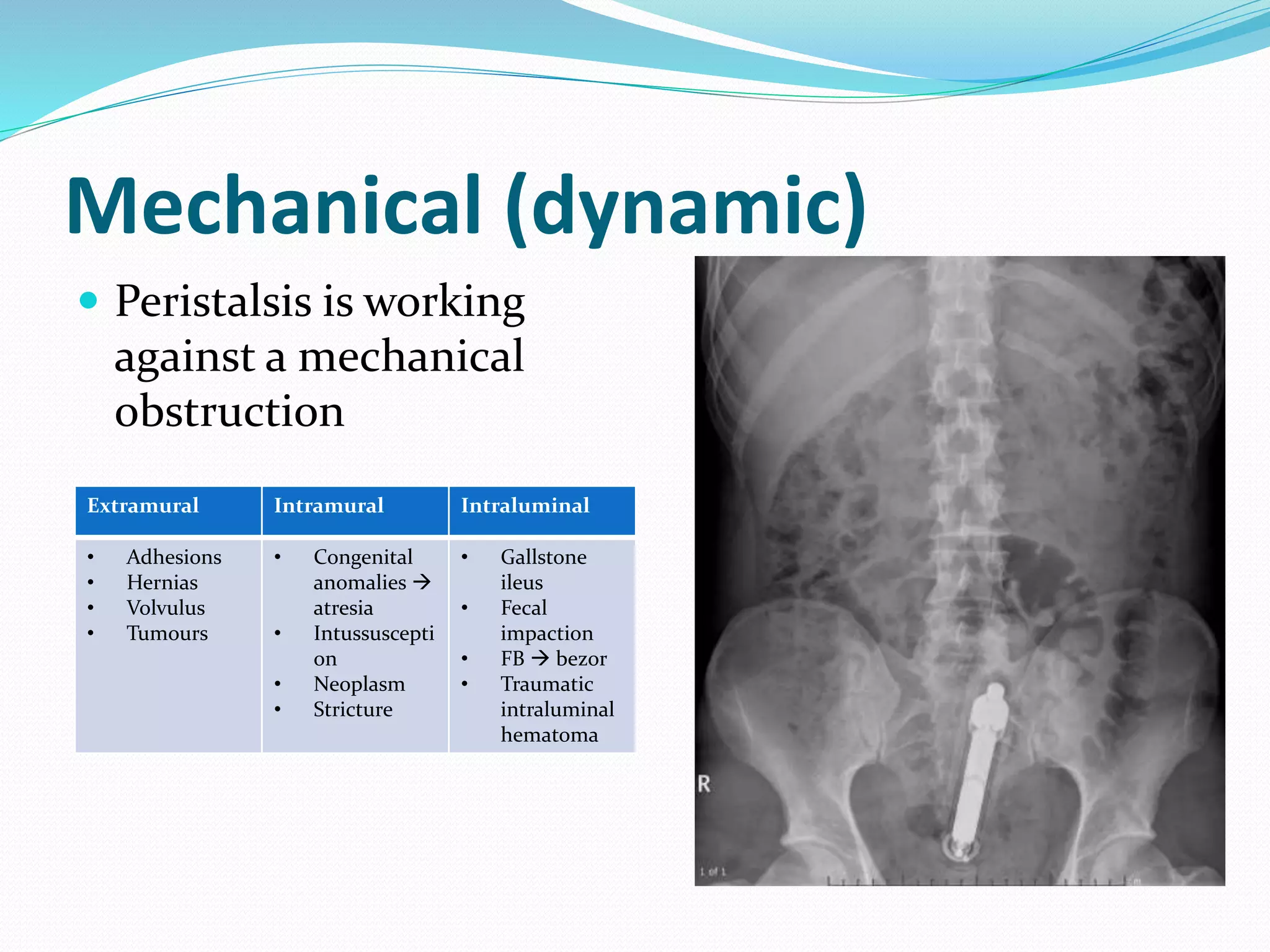 01.abdominal swelling 1 | PPTX