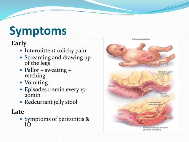 01.abdominal swelling 1 | PPTX
