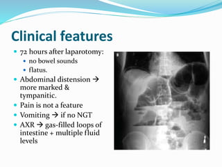01.abdominal swelling 1 | PPTX
