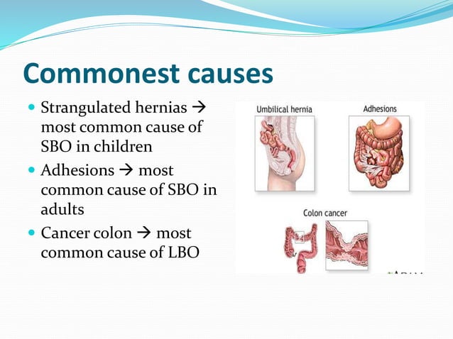 01.abdominal swelling 1 | PPTX
