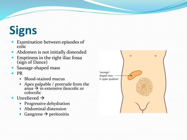 01abdominal Swelling 1