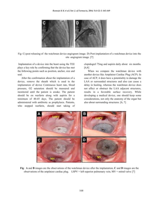 The Left atrial appendage closure - A watchman device | PDF