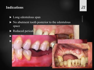 01. removable partial denture | PPTX