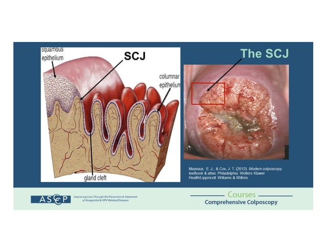 01. the normal cervix | PDF | Pregnancy | Reproductive Health