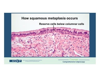 01. the normal cervix | PDF