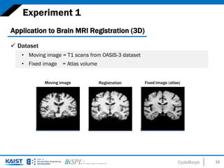CycleMorph: Cycle consistent unsupervised deformable image registration | PDF