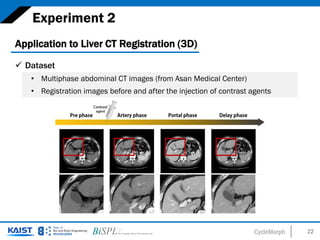 CycleMorph: Cycle consistent unsupervised deformable image registration | PDF