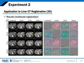 CycleMorph: Cycle consistent unsupervised deformable image registration | PDF