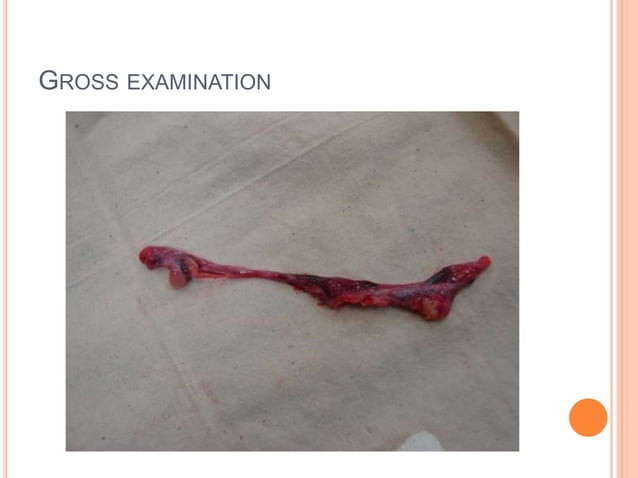 01 02 Ambiguous Genitalia Case Presentation Ppt