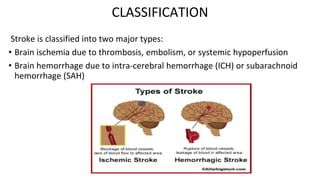 01. Stroke.pptx