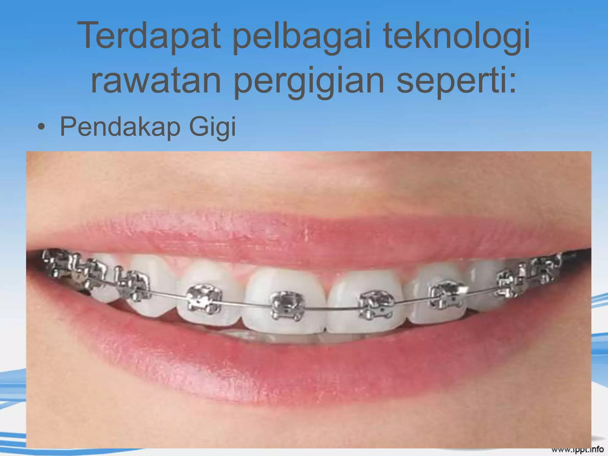 01. GIGI TAHUN 3.ppt