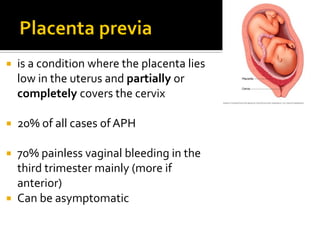 01.1_aph_6th_year_seminar_grp_aa in ism Kyrgyzstan | PPT