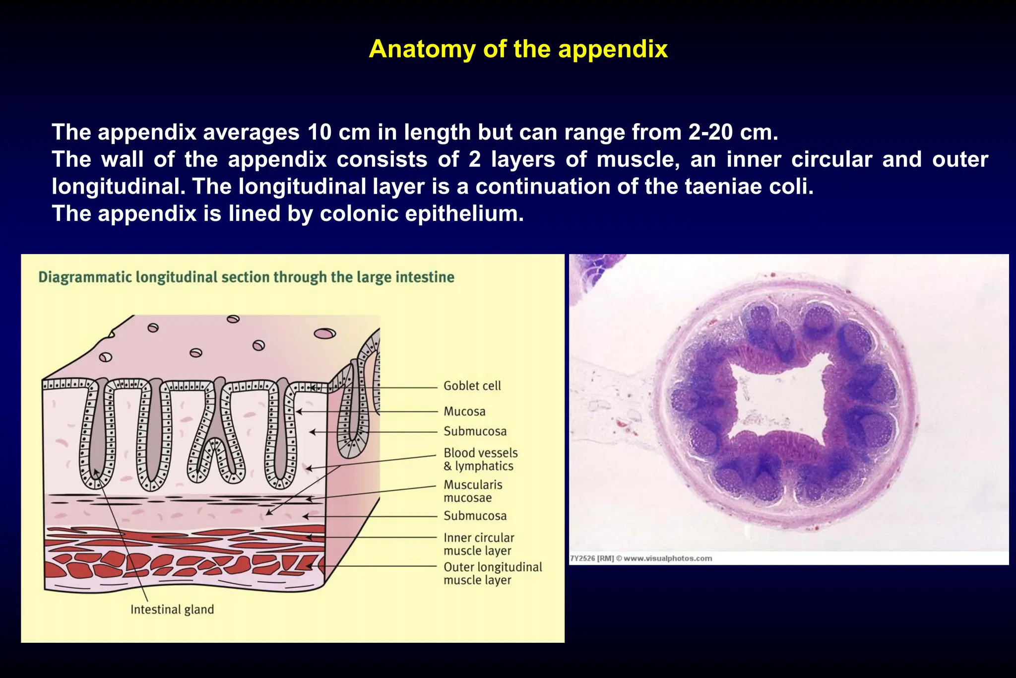 01.Acute appendicitis and chronic appendicitis.pdf