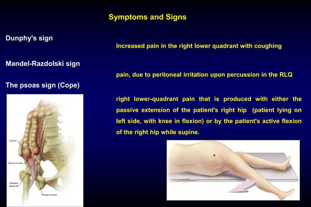 01.Acute appendicitis and chronic appendicitis.pdf