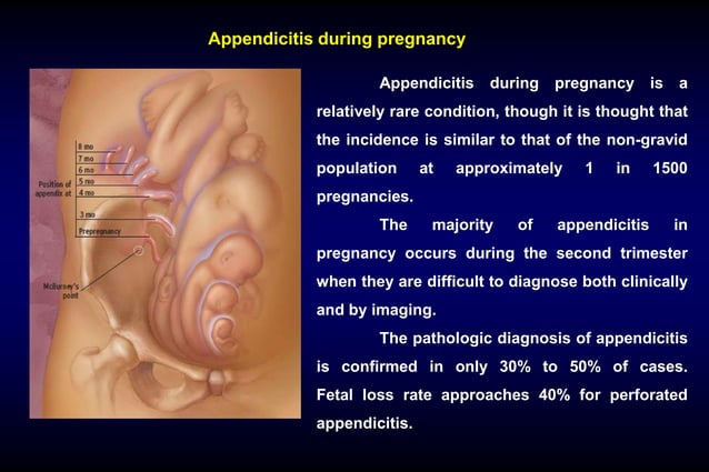 01.Acute appendicitis and chronic appendicitis.pdf