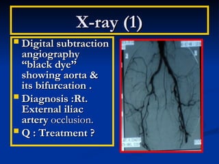 X0ray presentation for surgical health care | PPT