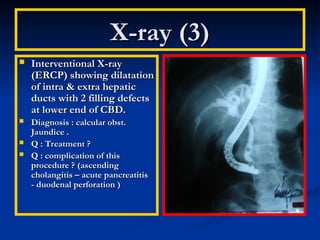 X0ray presentation for surgical health care | PPT