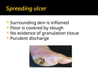ULCERS Classification and management.ppt