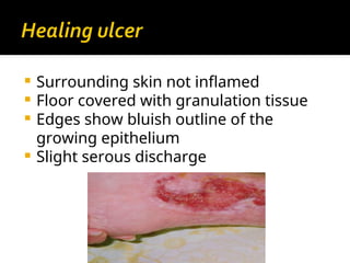 ULCERS Classification and management.ppt